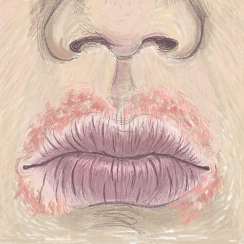 Droge lippen. Oorzaak, behandeling & droge lippen tips | Drs. Leenarts