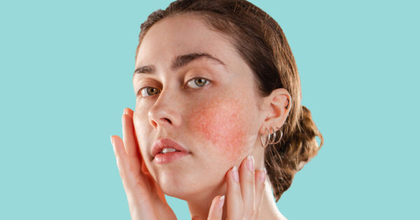 Wratten | oorzaak, behandeling en tips | Drs Leenarts